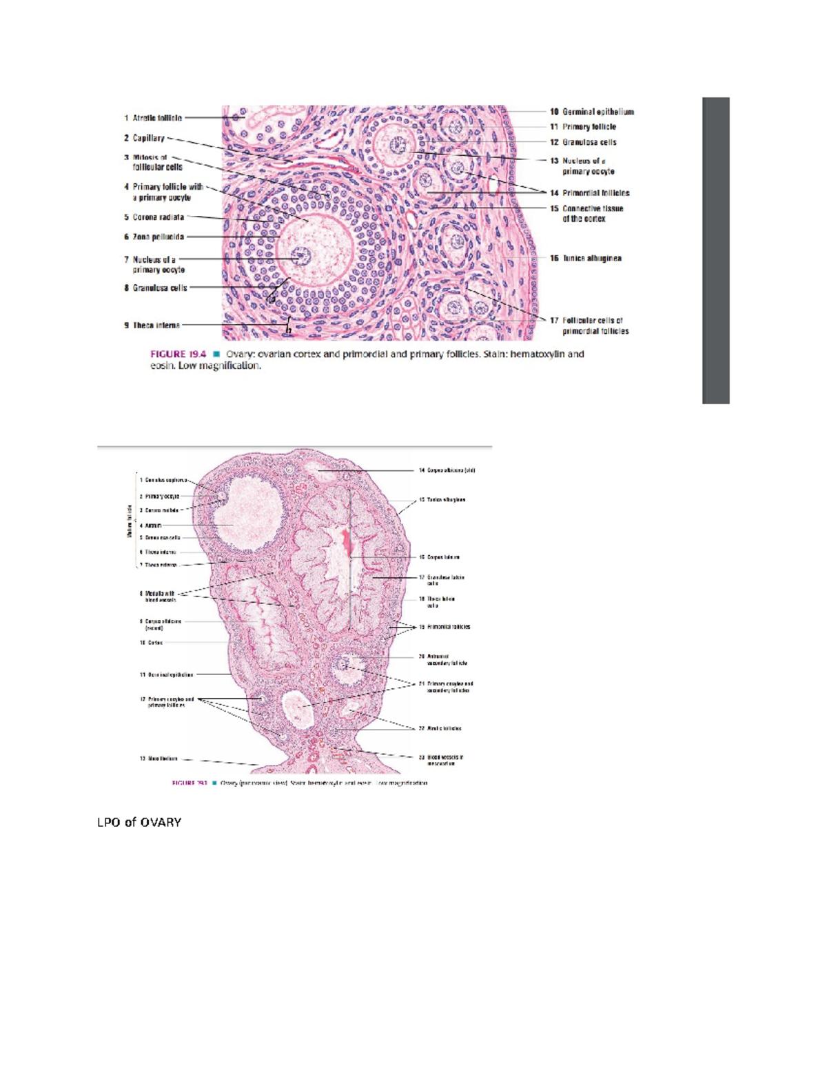 LPO-of- Ovary - LPO - LPO of OVARY OVARY HPO SOURCE DIFIORE QFR PART A ...