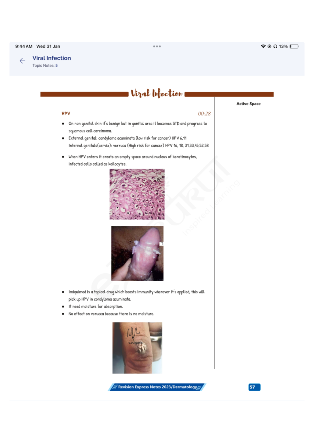 10 viral ds - Nice notes - 9:44 AM Wed 31 Jan O I Viral Infection Topic ...