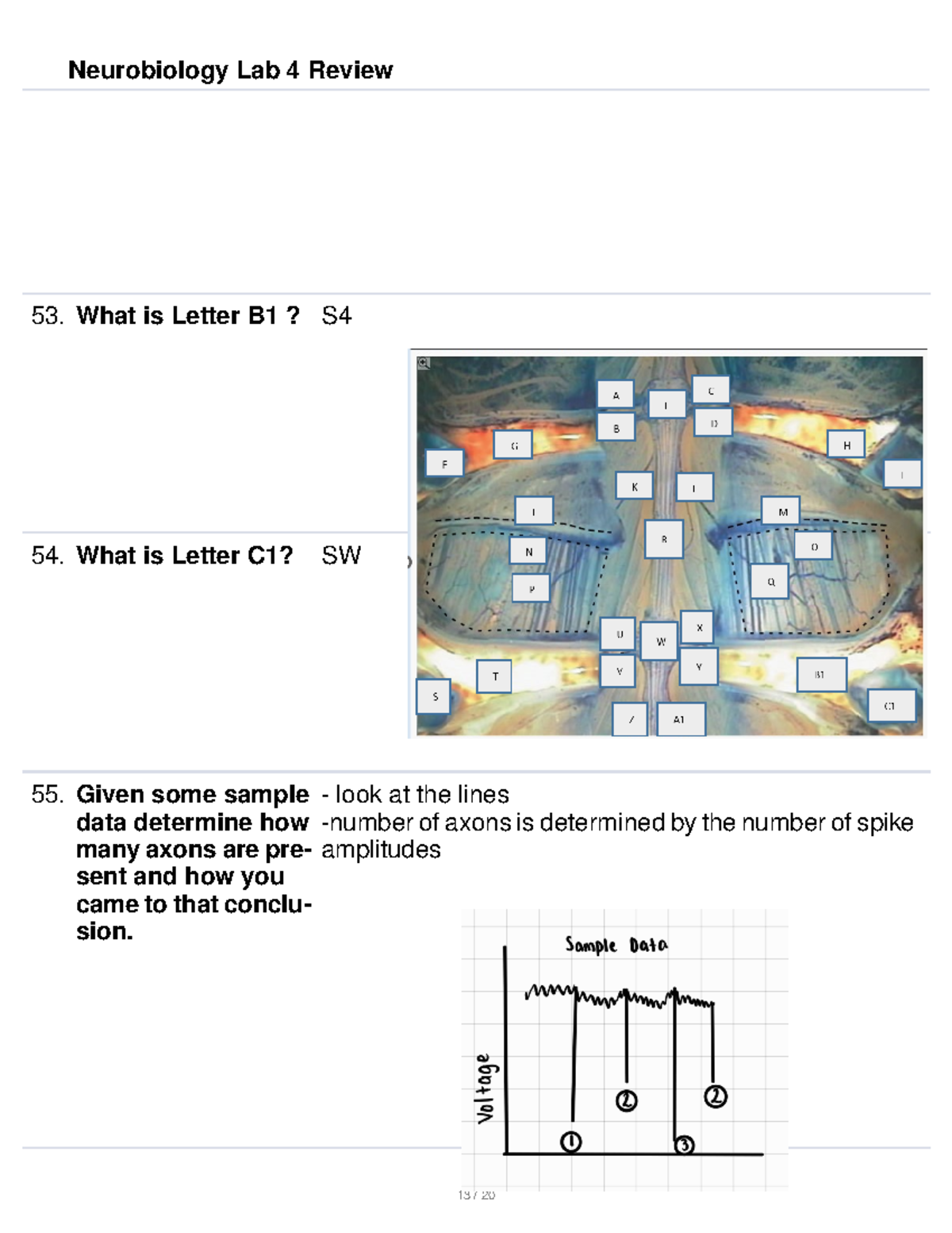 Neurobio lab review Part4 - What is Letter B1? S What is Letter C1? SW ...