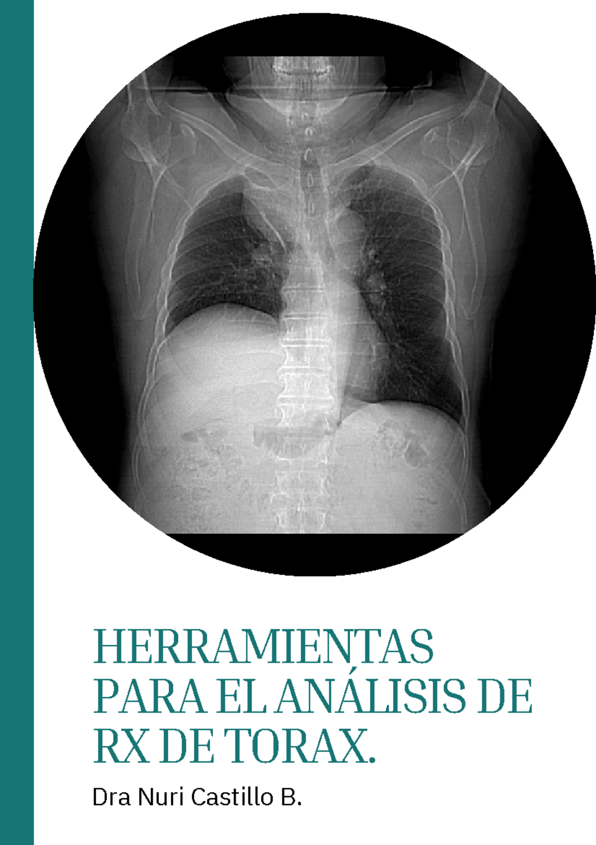 GUIA Basica RX DE Torax - HERRAMIENTAS PARA EL ANÁLISIS DE RX DE TORAX ...