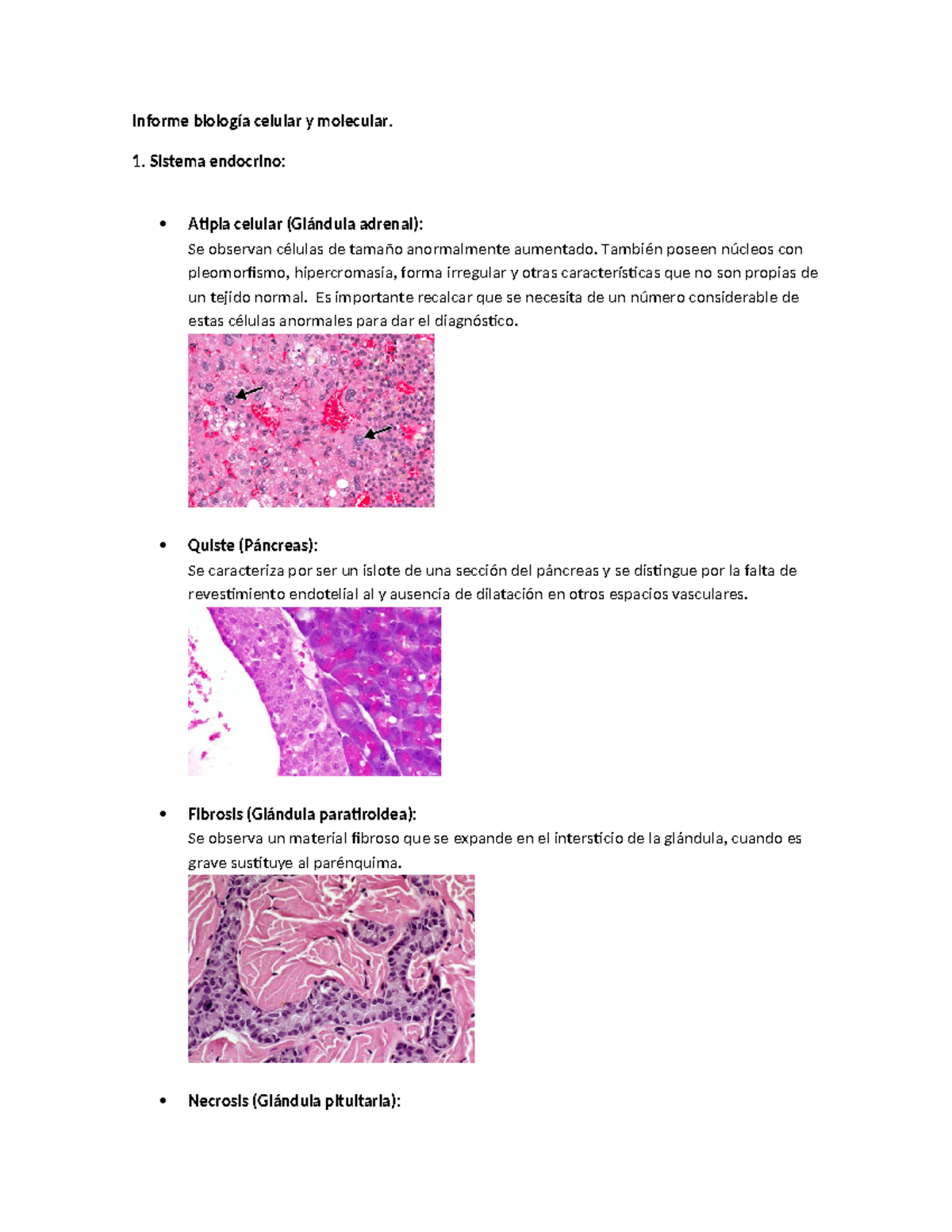 Informe biología celular y molecular - Sistema endocrino: Atipia ...