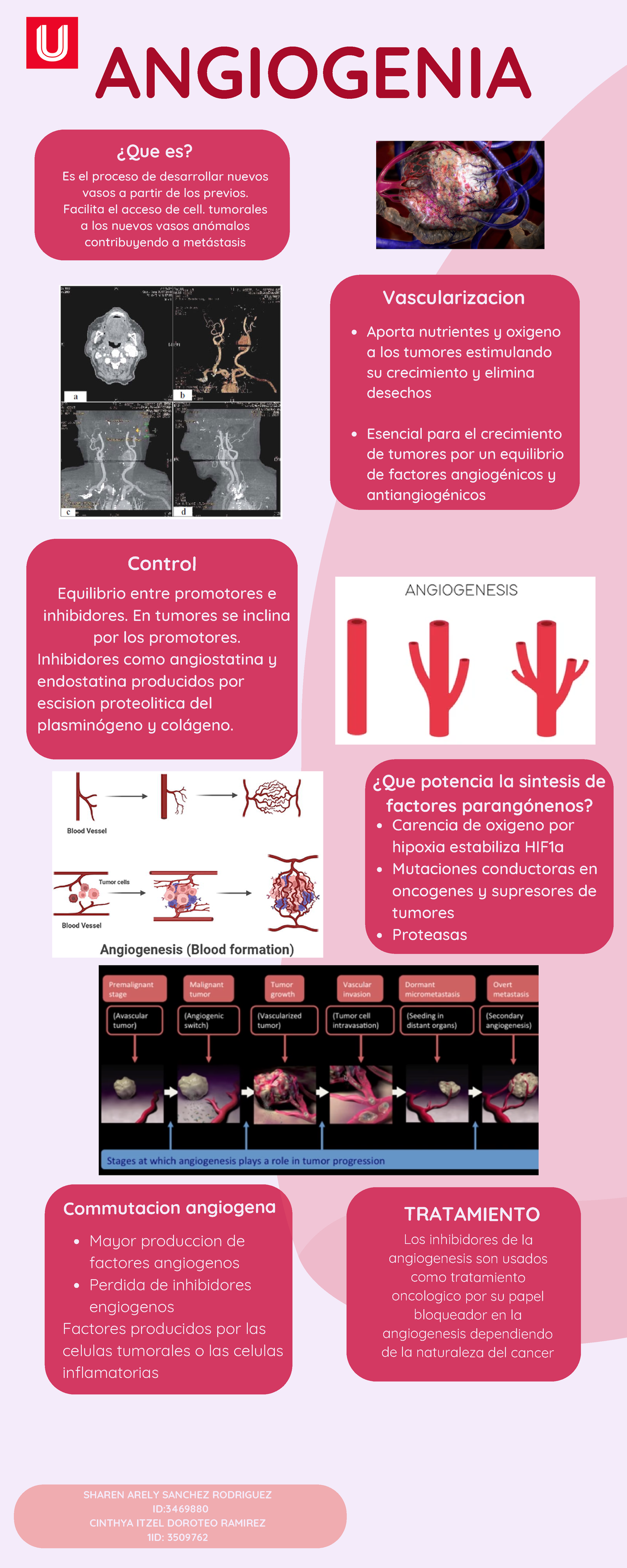 Anatomia PatolóGICA - Infografia de angiogenia - ¿Que es? ####### Es el ...