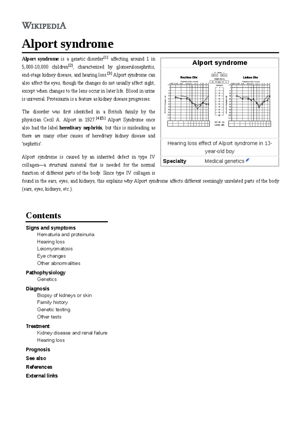 Alport syndrome - [3] Alport syndrome can also affect the eyes, though ...