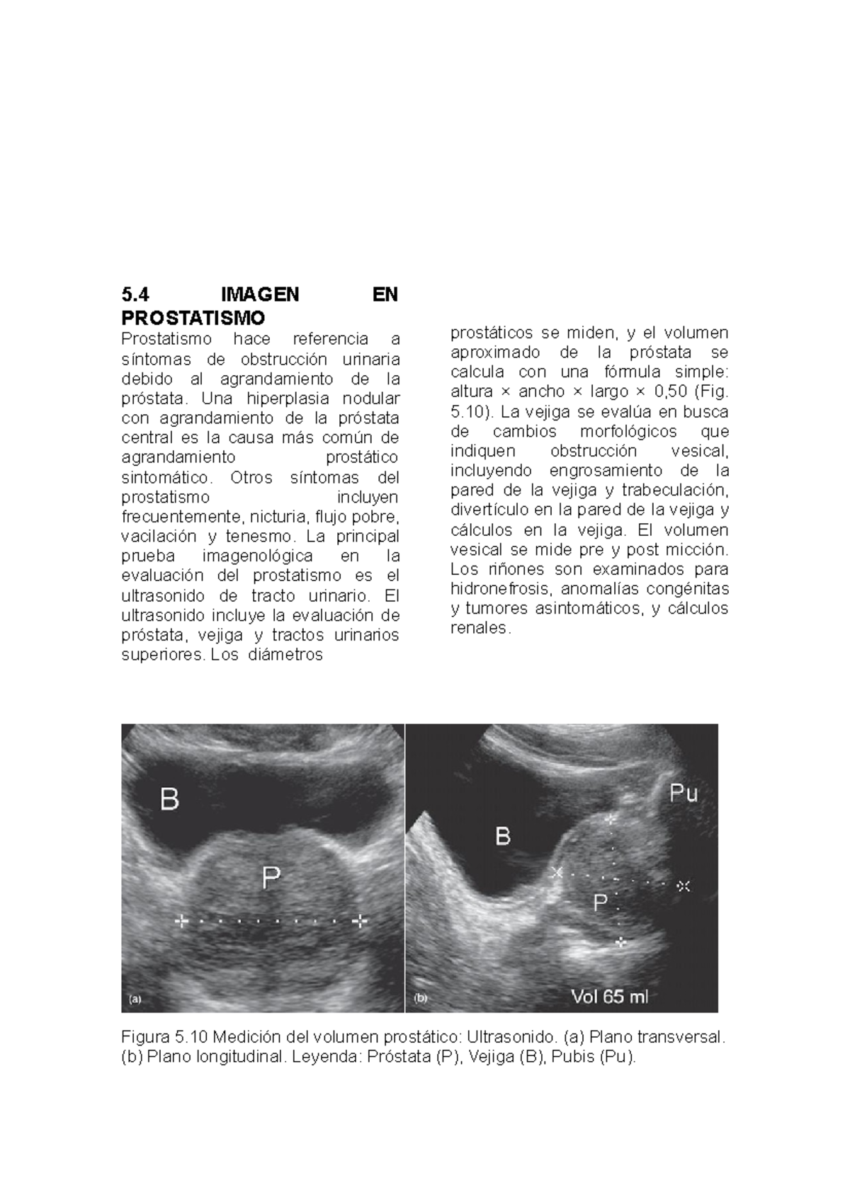 Parte 3 urologia - Resumen Learning Radiology: Recognizing the Basics ...