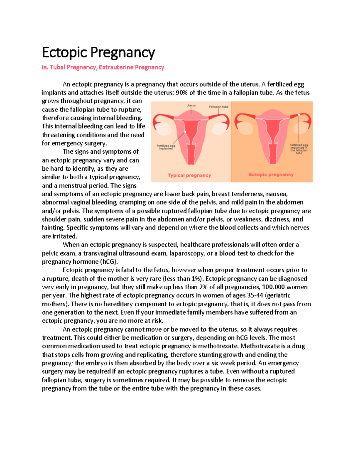 Ectopic Pregnancy Research - Ectopic Pregnancy ie. Tubal Pregnancy ...