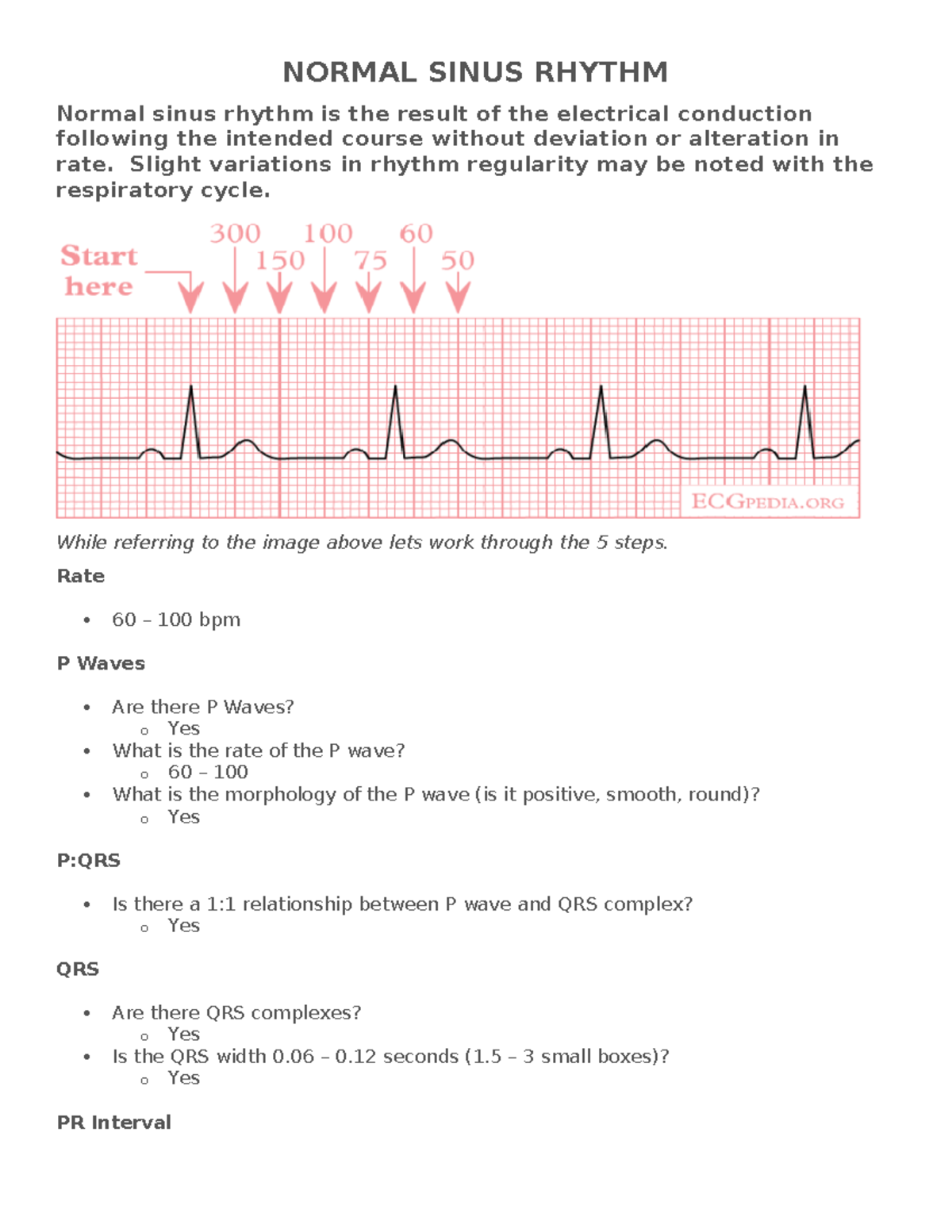 EKG Rhythm Interpretation Handout - NORMAL SINUS RHYTHM Normal sinus ...