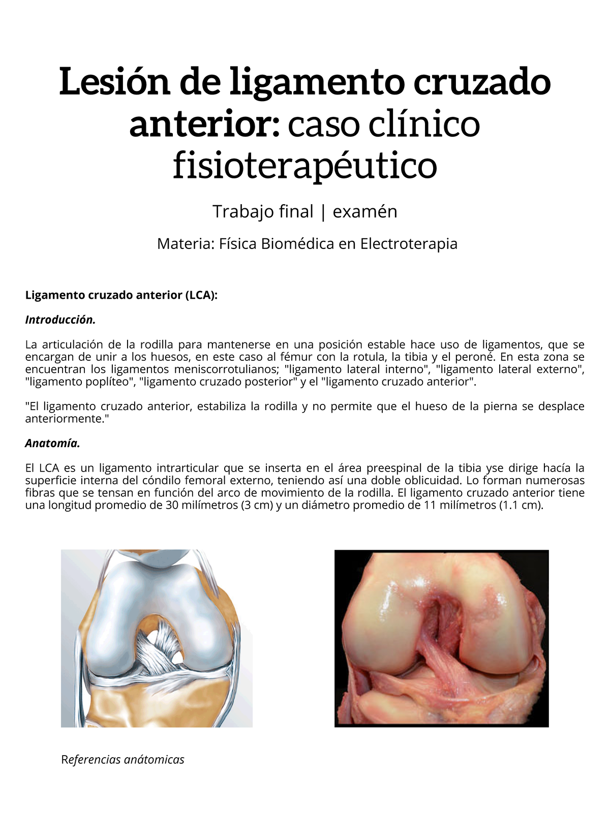 Lesión de ligamento cruzado anterior - Ligamento cruzado anterior (LCA ...
