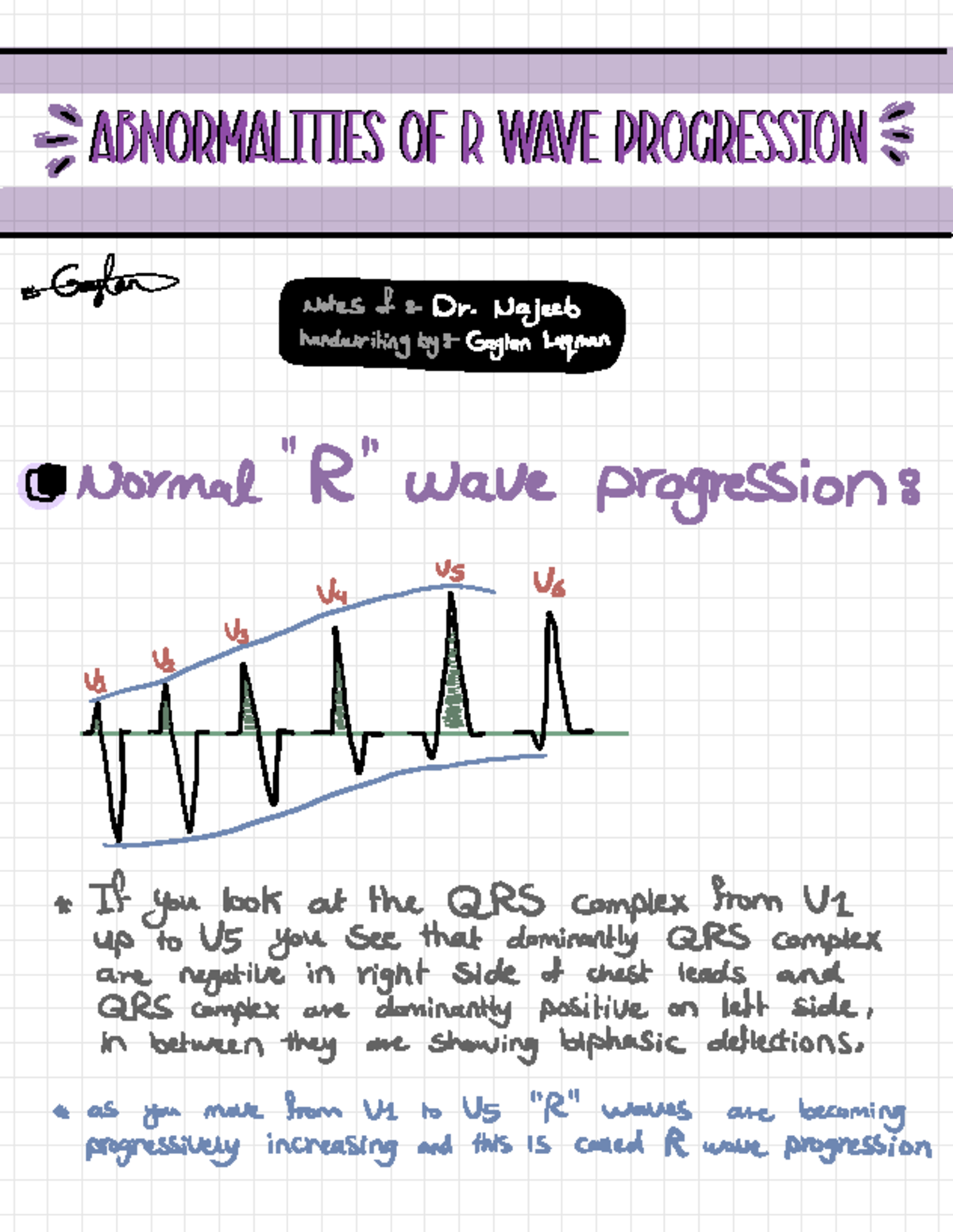 8- Abnormalities of R wave progression - Abnormalities of R wave ...