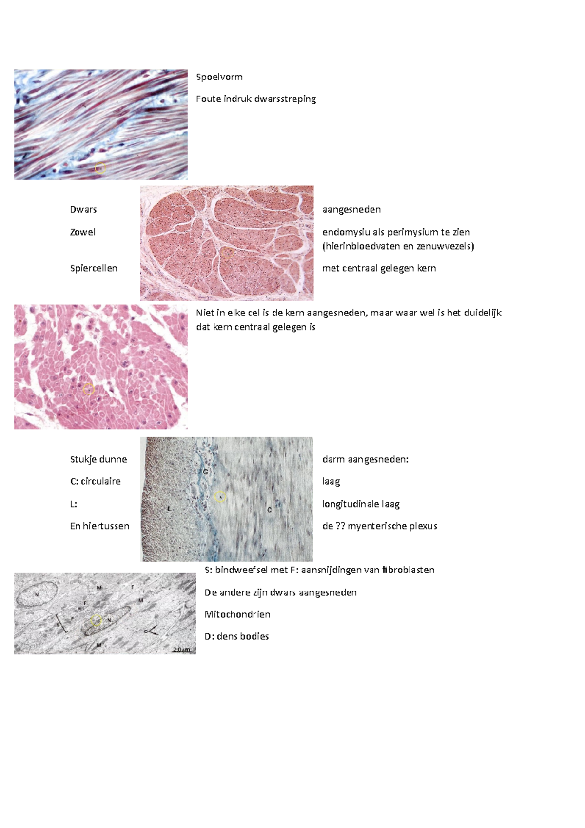 Extra uitleg foto's glad spierweefsel - Spoelvorm Foute indruk ...