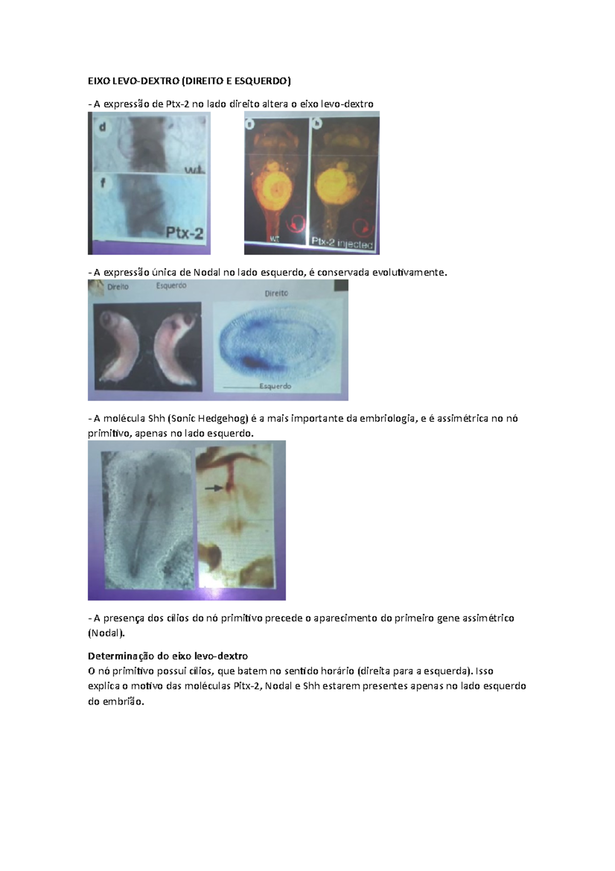 Eixo Levo-Dextro - Anotações da aula ministrada pelo professor ...