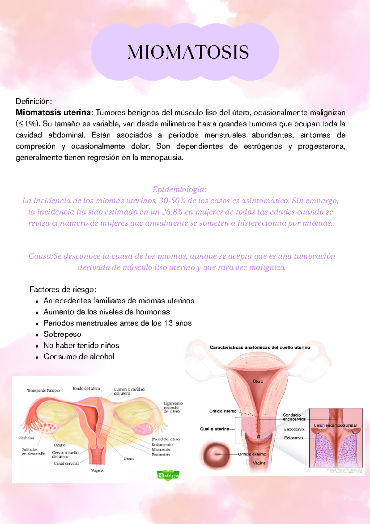 Miomatosis y medicamentos - MIOMATOSIS Definición: Miomatosis uterina ...