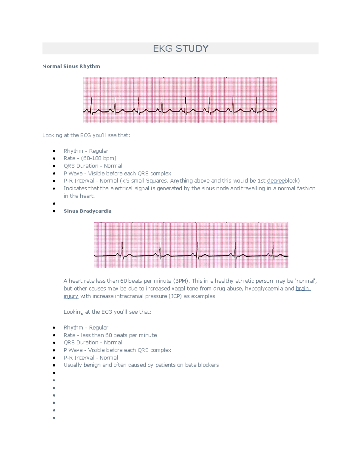 EKG Study - EKG interpreting and learning strips. Identifying ...