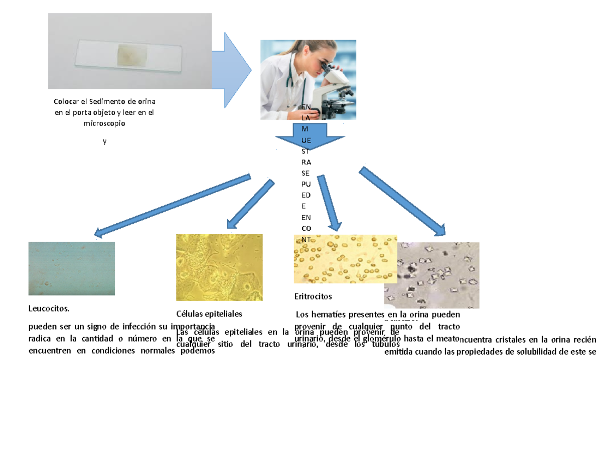 examen microscópico de sedimento en examen de orina para observar si ...