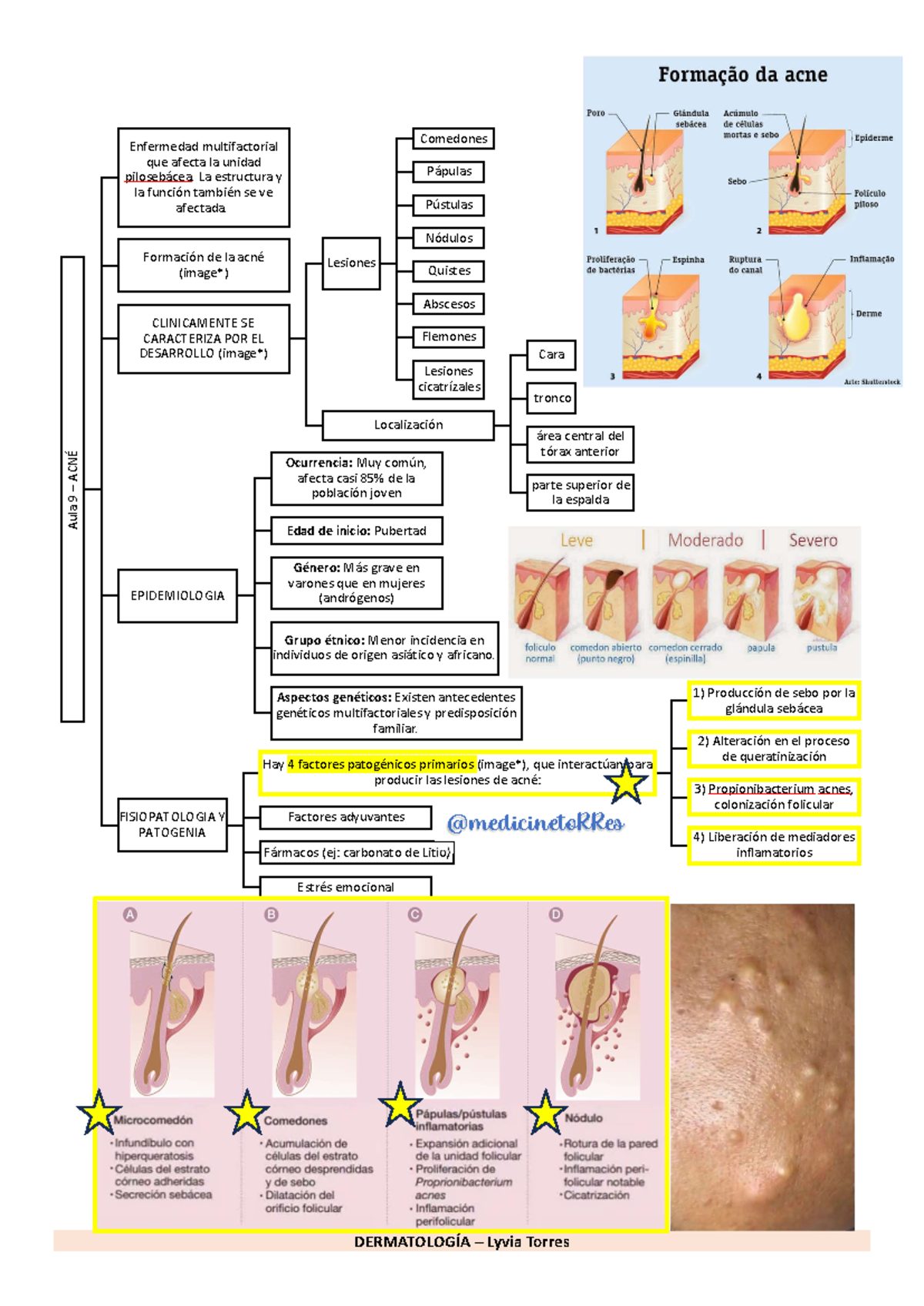 Acné - DERMATOLOGÍA – Lyvia Torres Aula 9 – ACNÉ Enfermedad ...