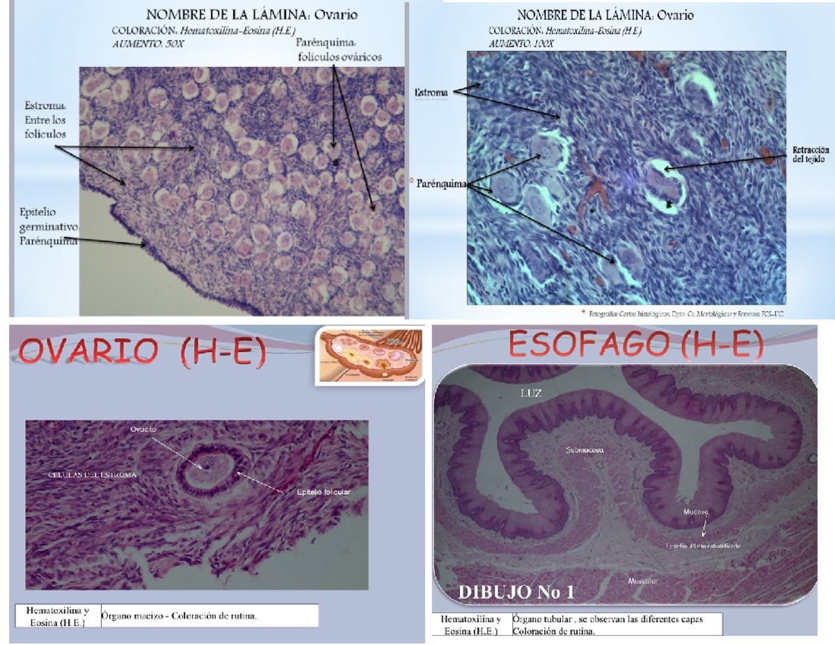 Laminas histologia - Cortes histologicos. muestras. tincion ...