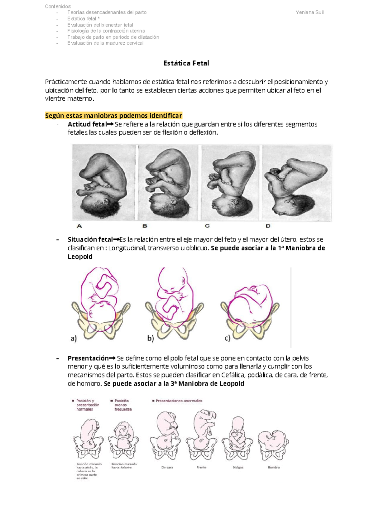 Resumen de Obstetricia - Contenidos: desencadenantes del parto Estatica ...