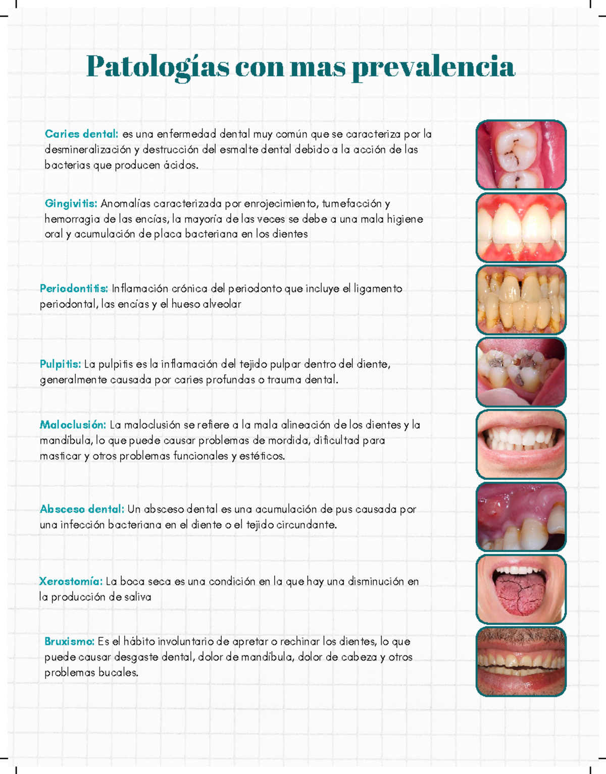 Odonto - Bruxismo: Es el hábito involuntario de apretar o rechinar los ...