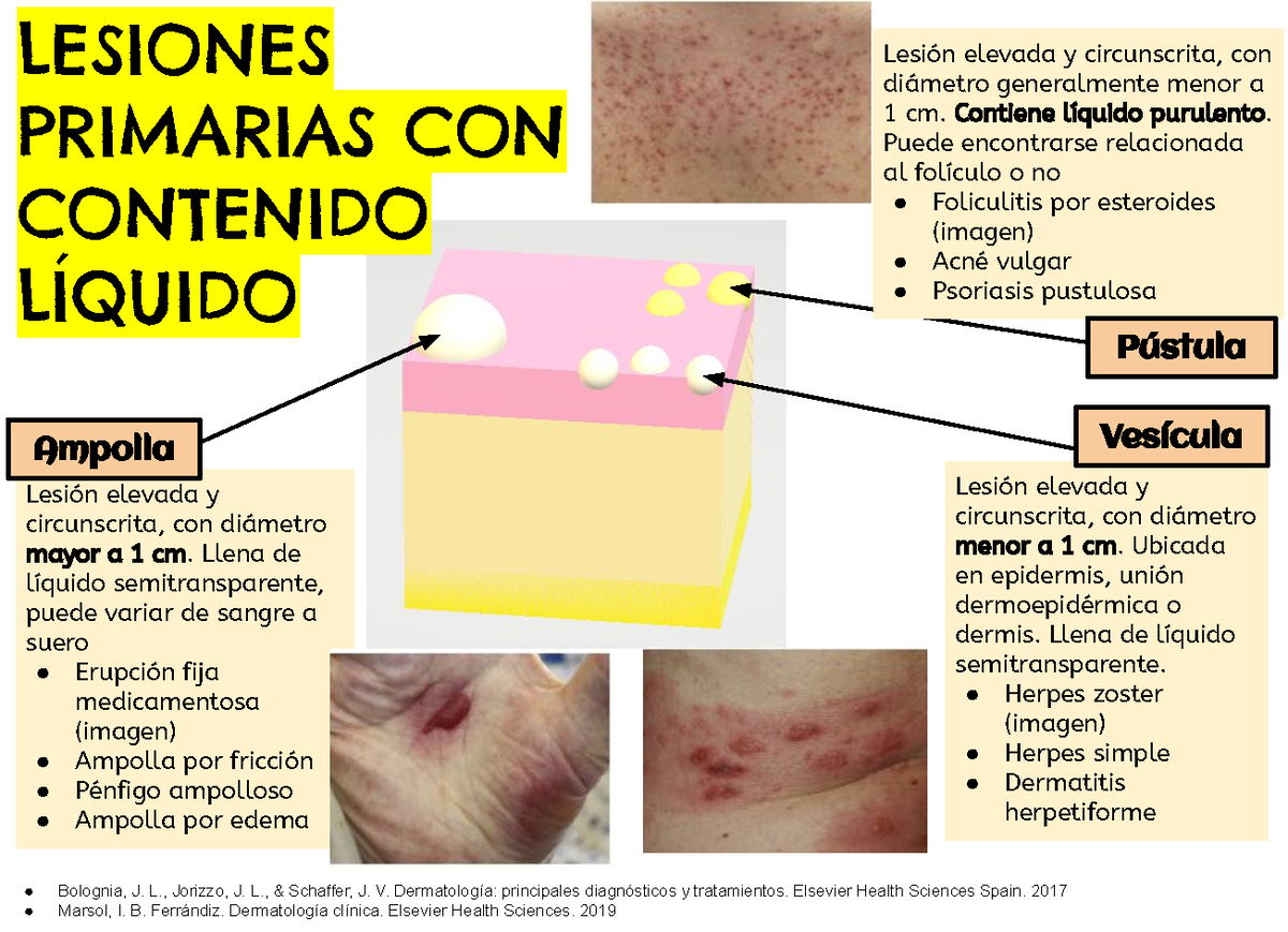 Tarea tegumentario semana 5 absorcion de la piel y lesiones - Lesión ...