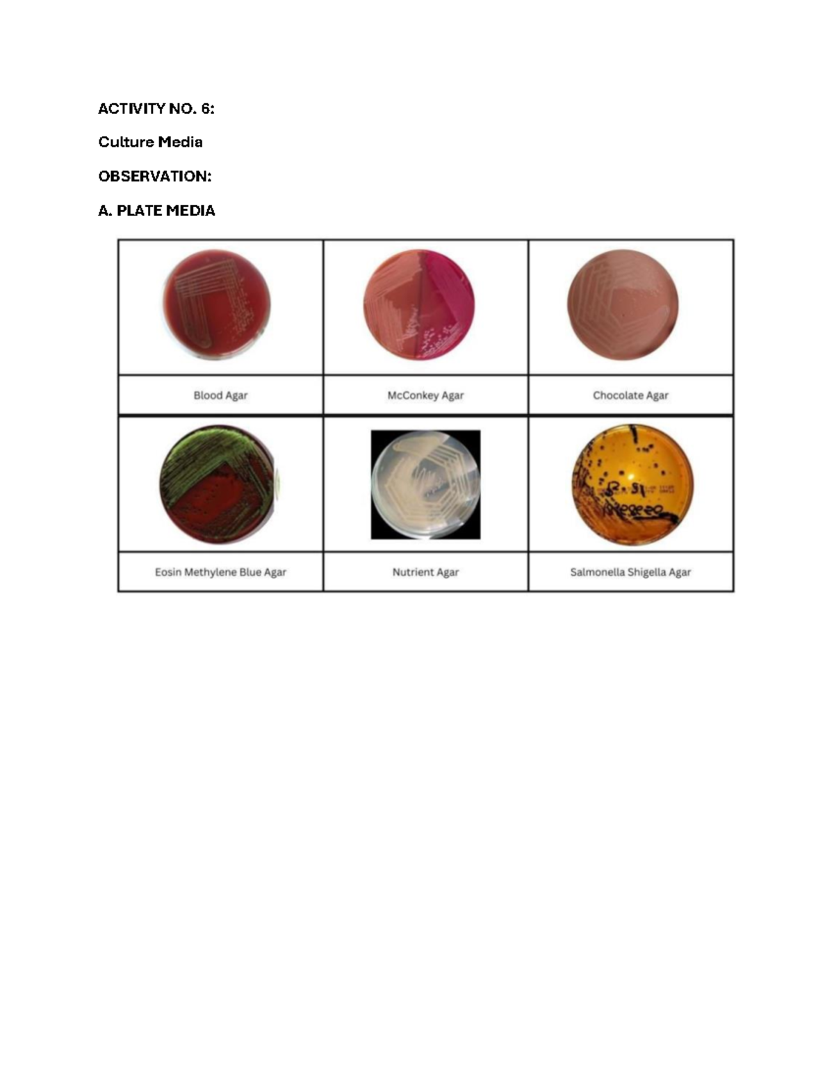 SAS-6 - macropara - ACTIVITY NO. 6: Culture Media OBSERVATION: A. PLATE ...