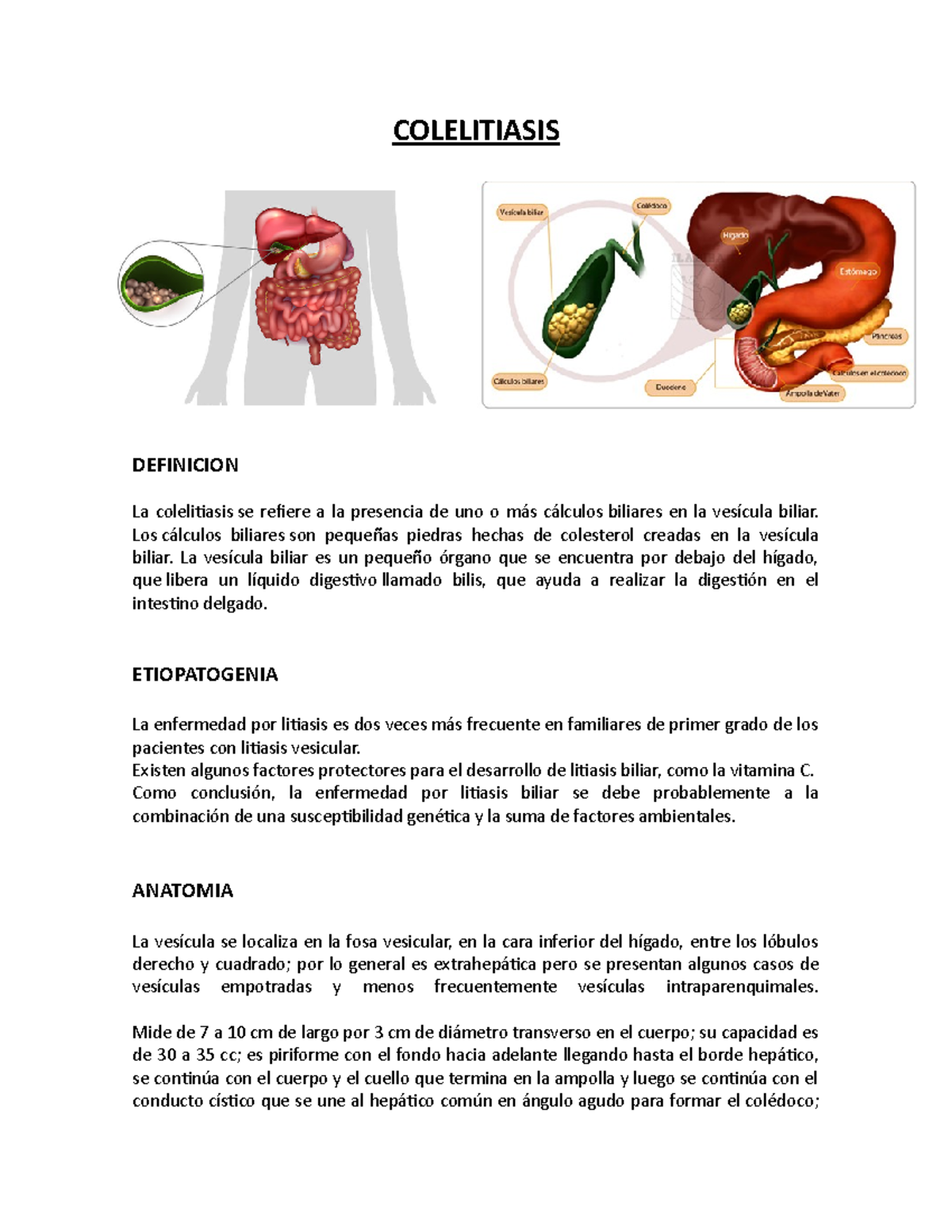 Resumen Colelitiasis - COLELITIASIS DEFINICION La colelitiasis se ...