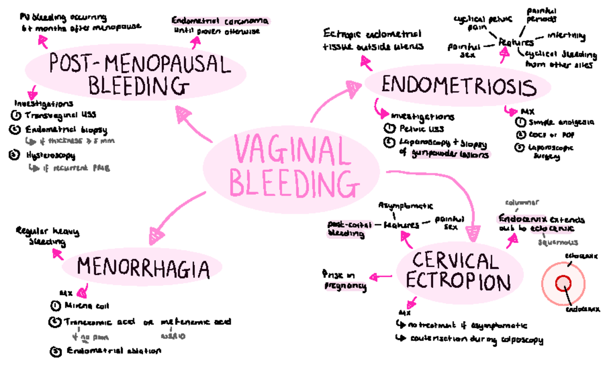 Gynaecology spider diagrams - or painful bleeding occurring # adometual ...
