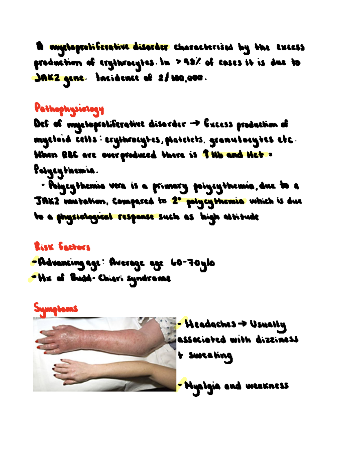 Polycythemia Vera - Clinical presentation Laboratory diagnosis ...