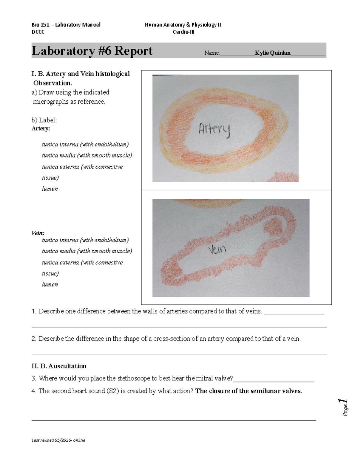 Lab6-Bio151-Cardio III- Report-2020-1 - DCCC Cardio-III Laboratory #6 ...