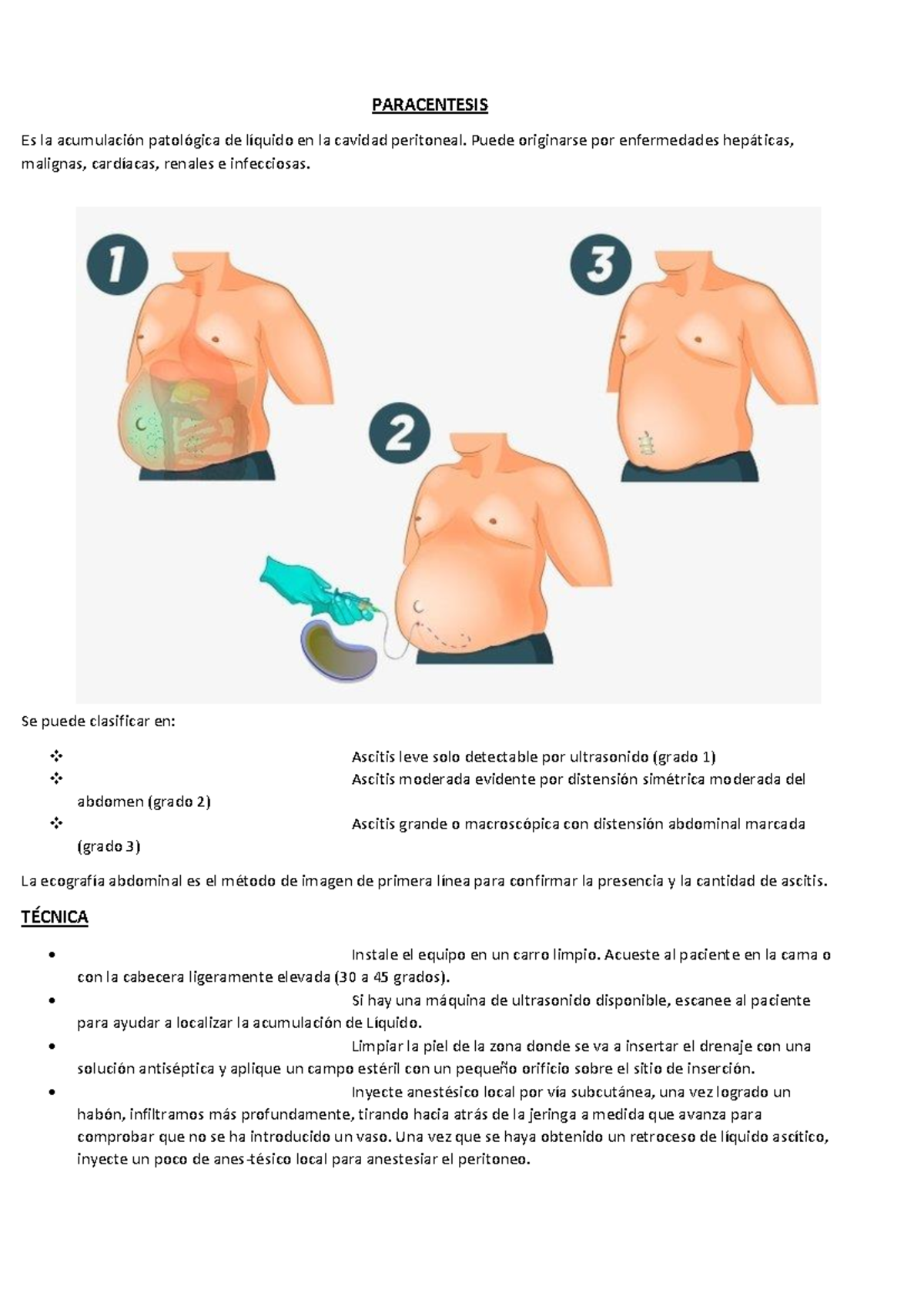 Paracentesis - Espero te sirva y sino no. - PARACENTESIS Es la ...