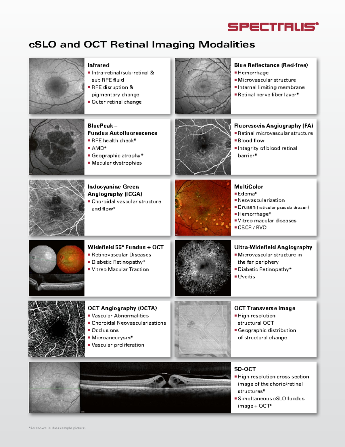 Tipos de imagen OCT - cSLO and OCT Retinal Imaging Modalities Infrared ...