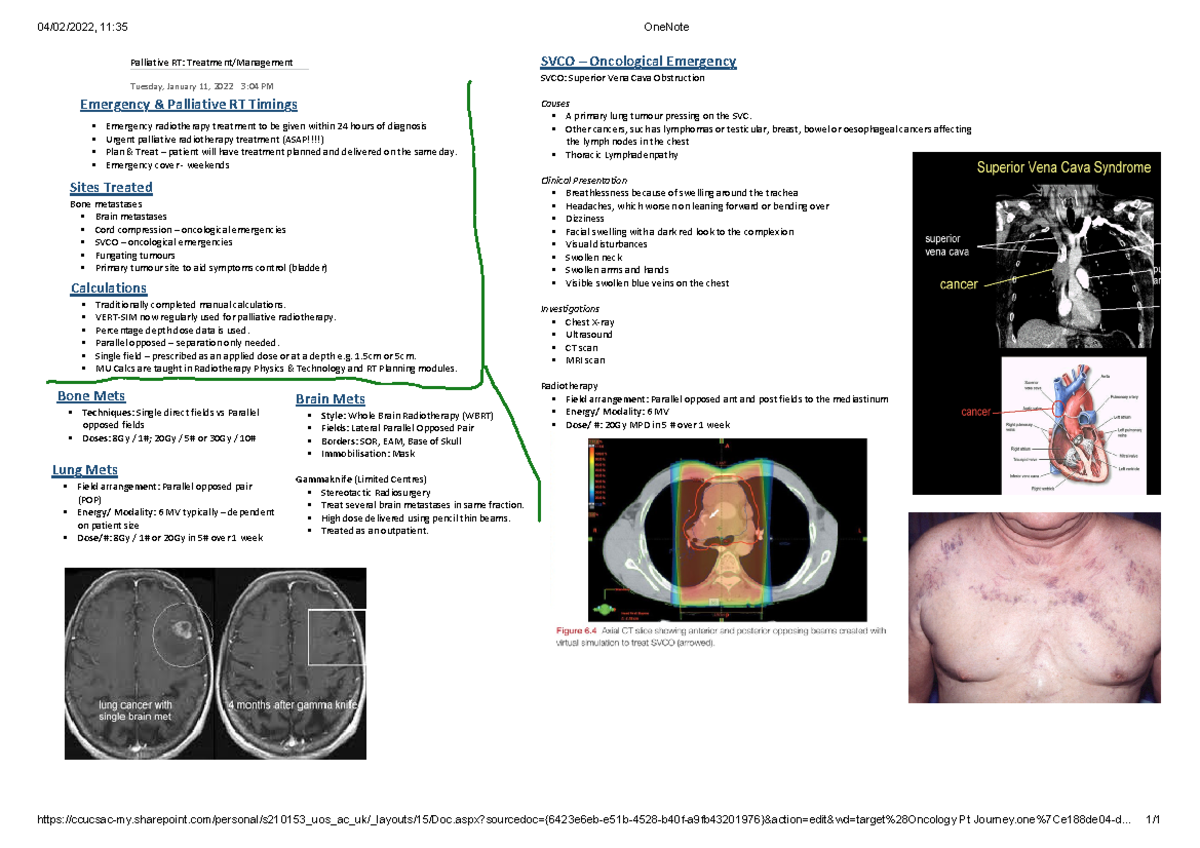 Palliative Radiotherapy (Management & Treatments) - 04/02/2022, 11:35 ...