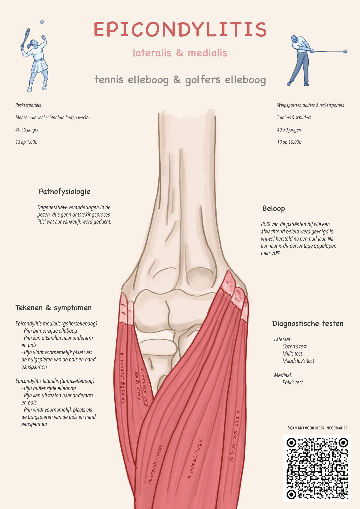 Infographic epicondylis lateralis en medialis - EPICONDYLITIS lateralis ...