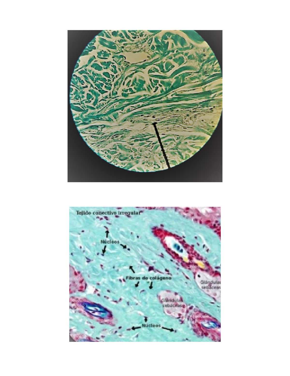Dermis Reticular (2) - Histología - Tejido conectivo Irregular Núcieos ...