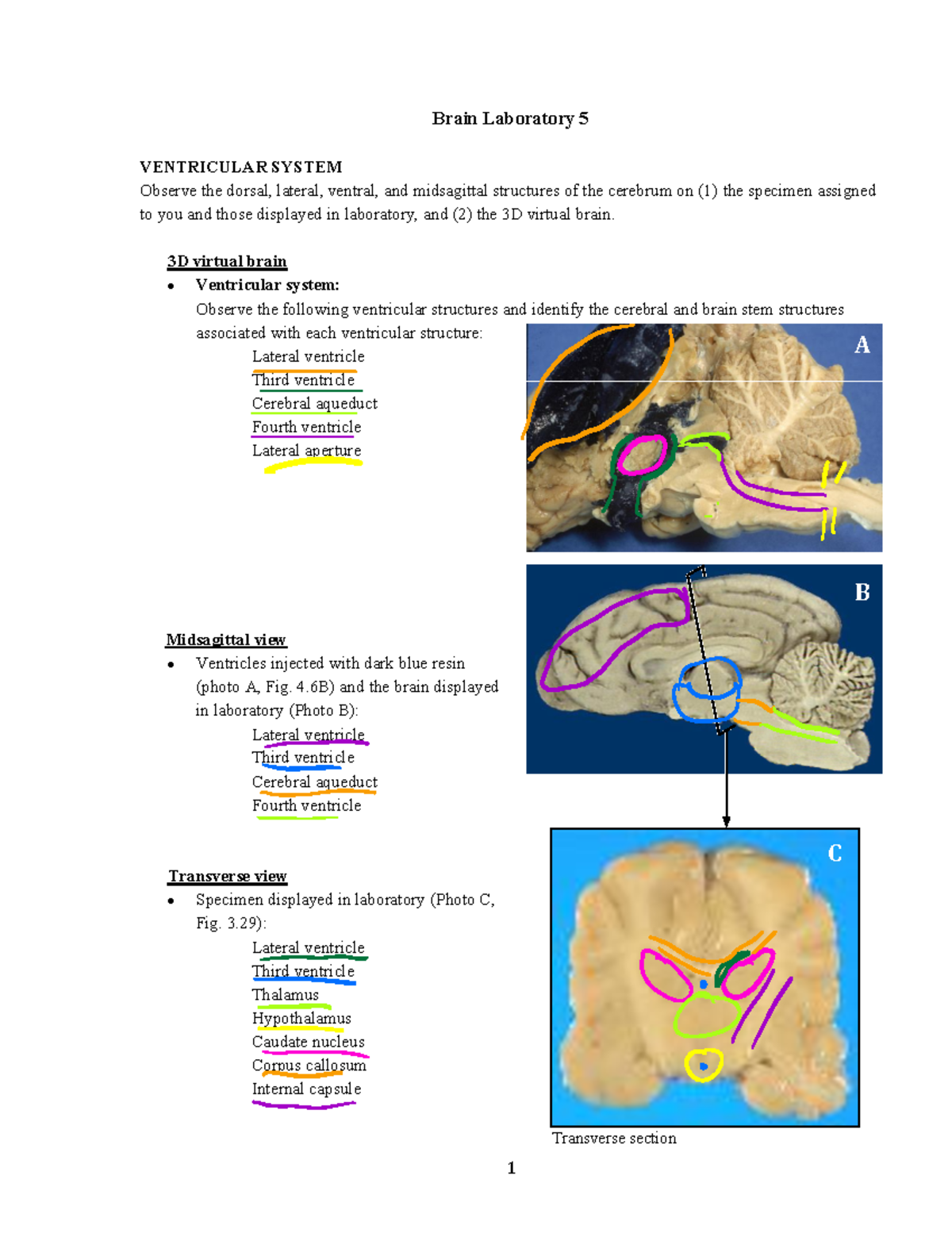 Lab 5 - lab guide - Brain Laboratory 5 VENTRICULAR SYSTEM Observe the ...