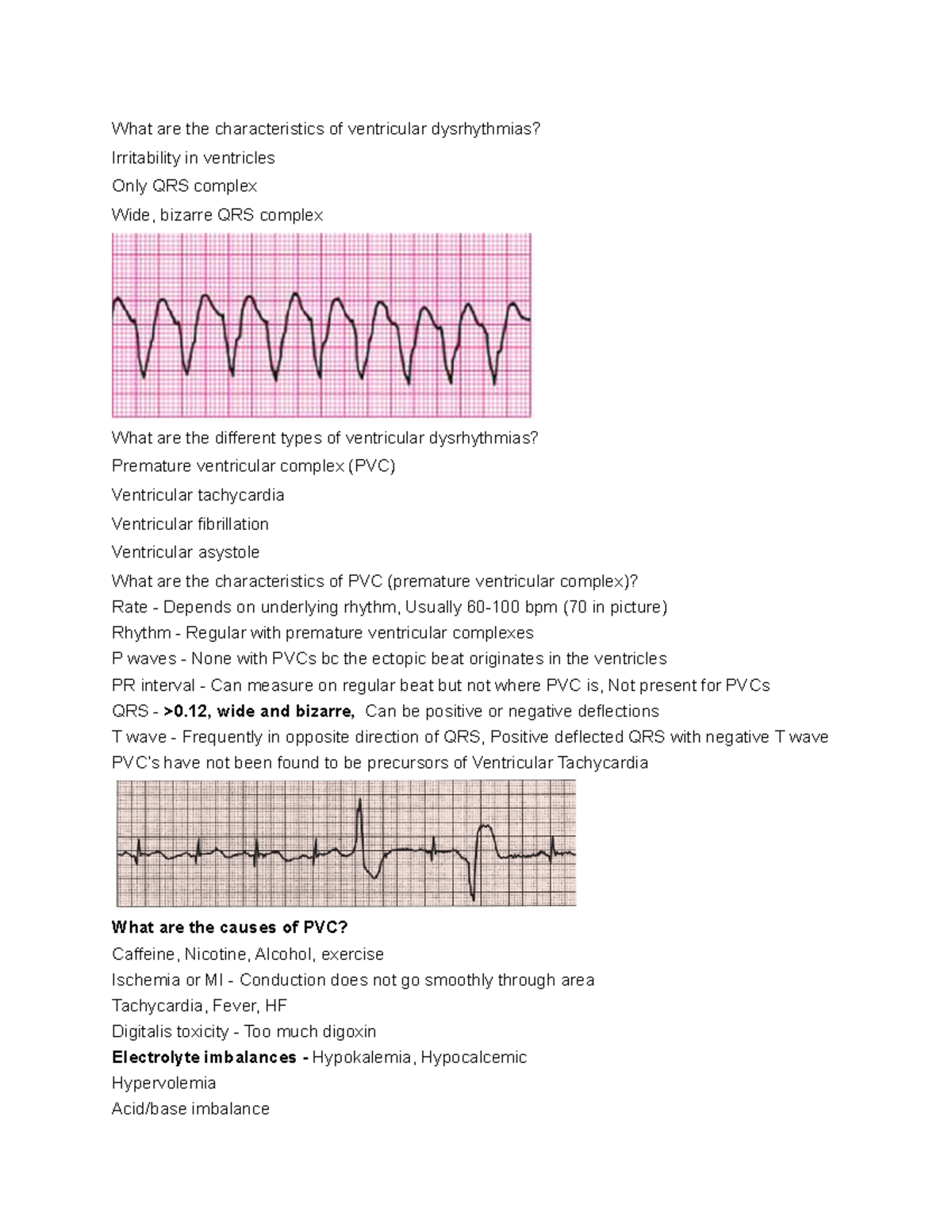 N420 Ventricular Dysrhythmias, Asystole, PEA - What are the ...