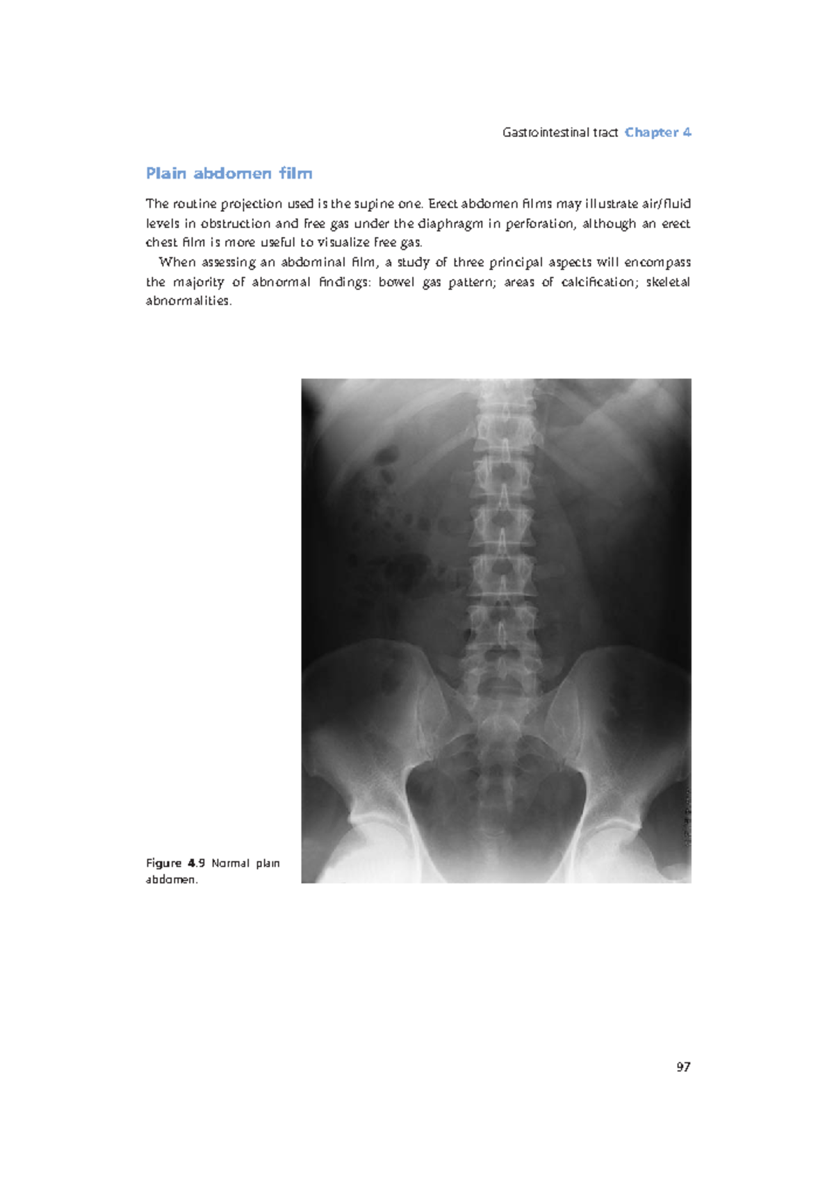 Radiology Lecture Notes pdf (33) - Gastrointestinal tract Chapter 4 97 ...