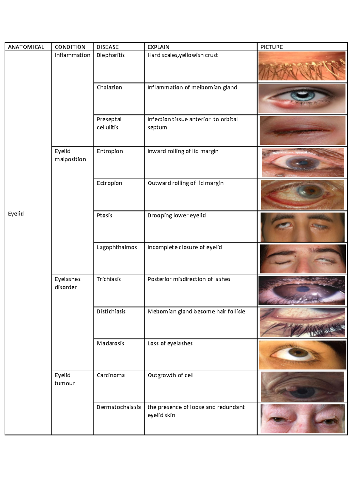 Disease - GOOD - ANATOMICAL CONDITION DISEASE EXPLAIN PICTURE Eyelid ...