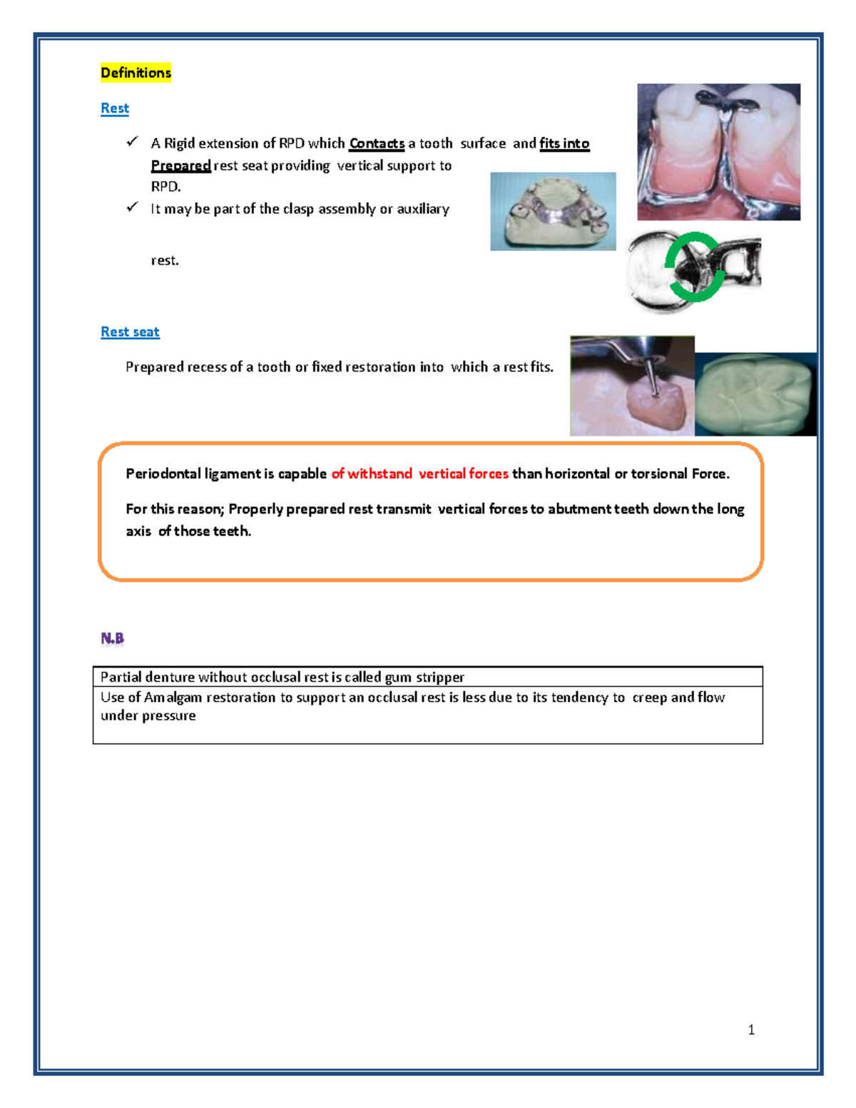 Rest & Rest seat جديد - Definitions Rest A Rigid extension of RPD which ...