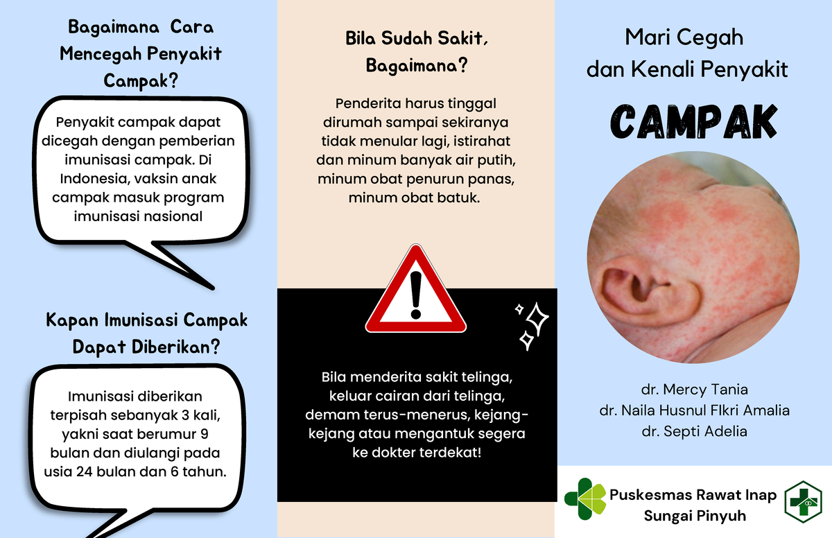 Definisi dan tatalaksana campak - Puskesmas Rawat Inap Sungai Pinyuh Bagaimana Cara Mencegah ...