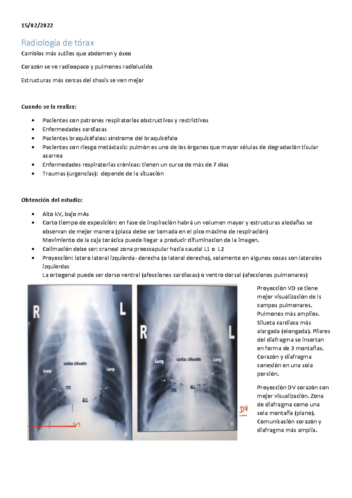 Examen Final - 15/02/ Radiología de tórax Cambios más sutiles que ...