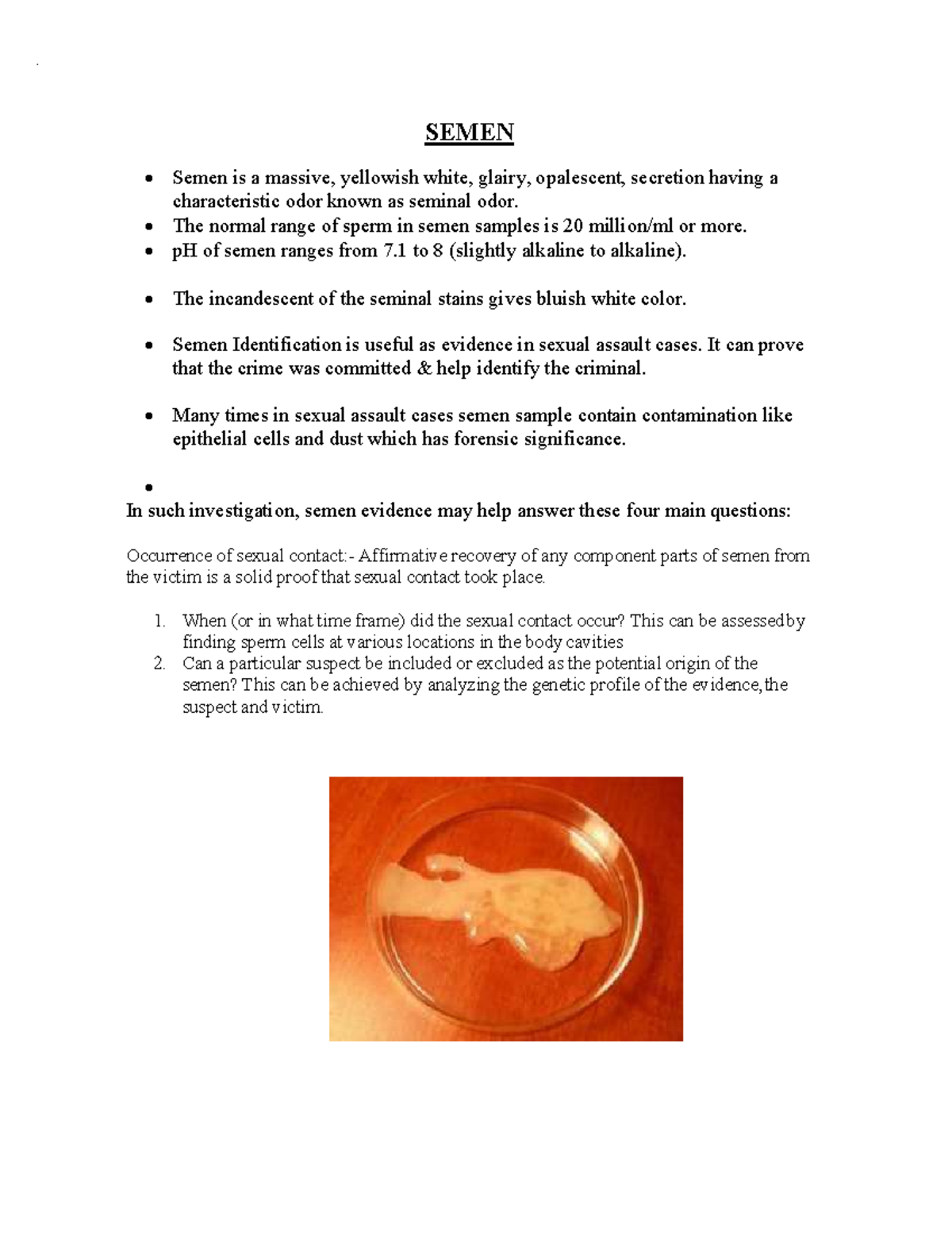 defenition , structure, charatcter of human semen - . SEMEN Semen is a ...