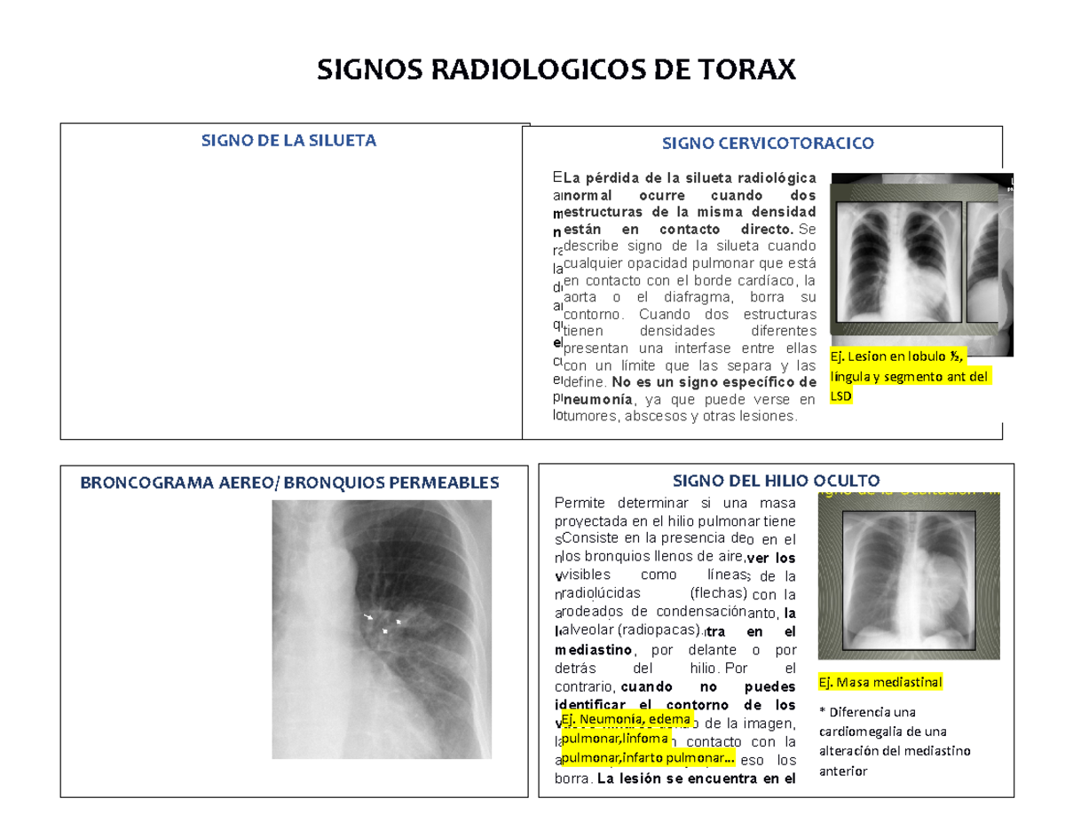 Signos Rx Tx Flash CARD - Give ip - SIGNOS RADIOLOGICOS DE TORAX SIGNO ...