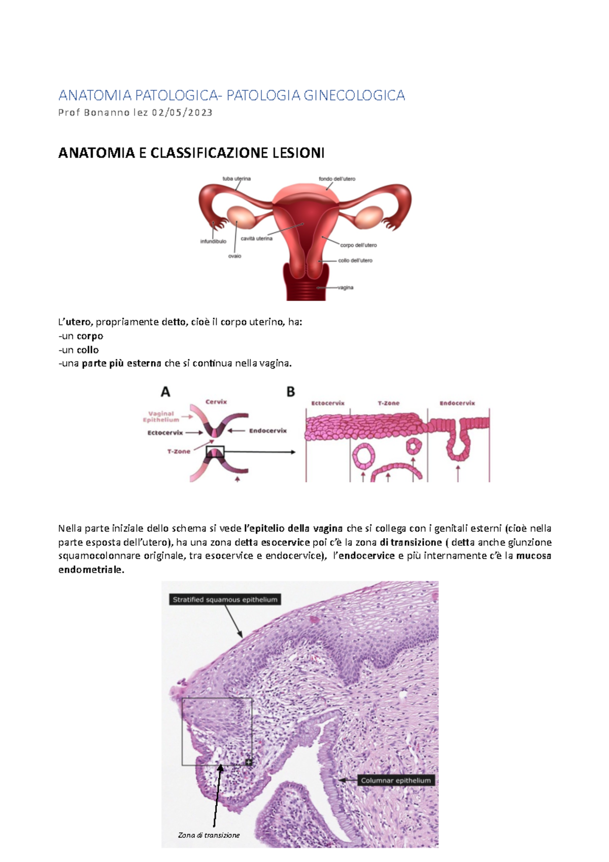 4- Carcinoma della cervice uterina - ANATOMIA PATOLOGICA- PATOLOGIA ...