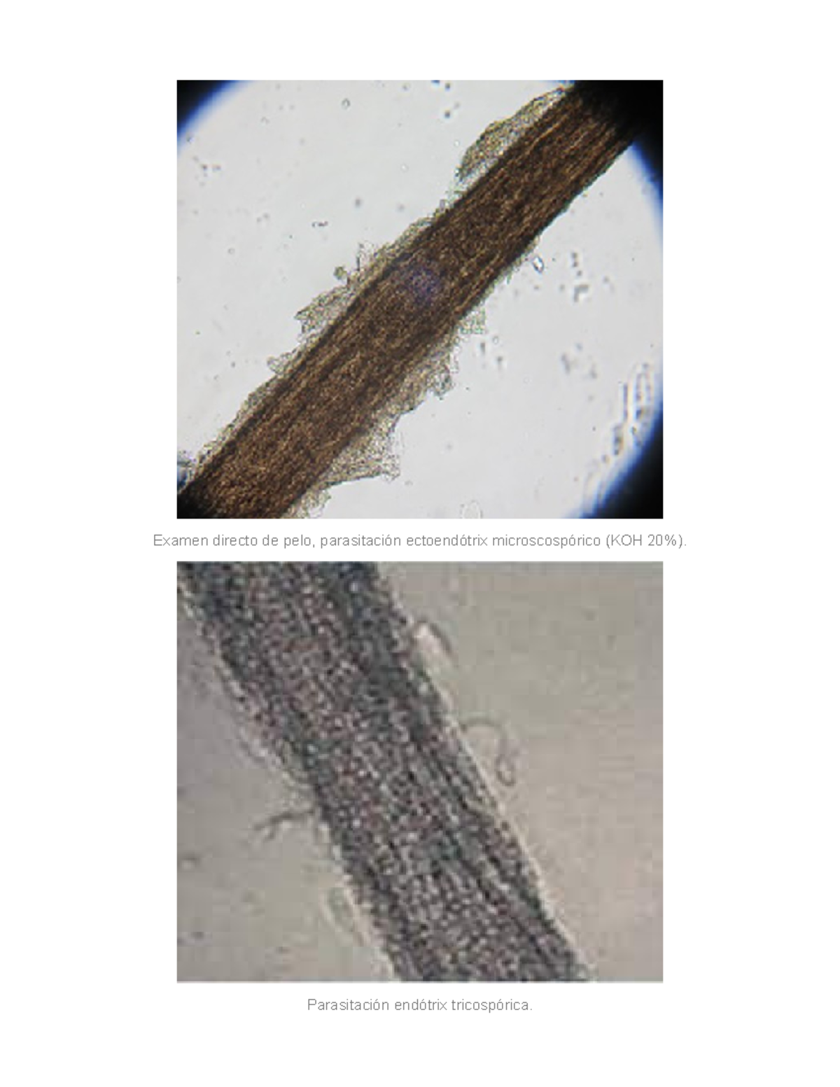 Imagenes de micosis superficiales - Examen directo de pelo ...