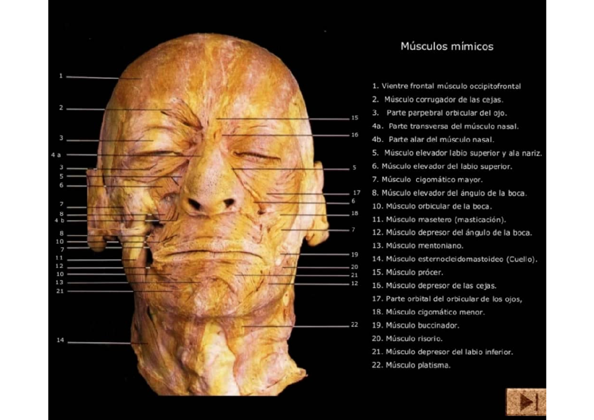 Musculos cadaver - Músculos de imagen real - Medicina - Studocu