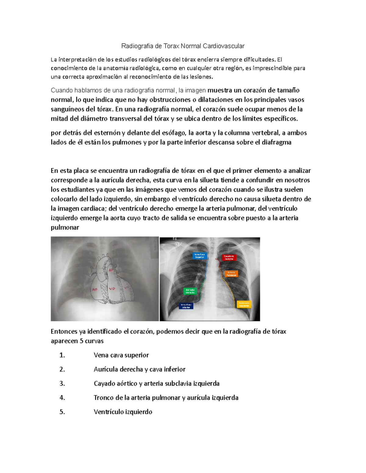 Informe pm radiografia de torax - Radiografia de Torax Normal ...