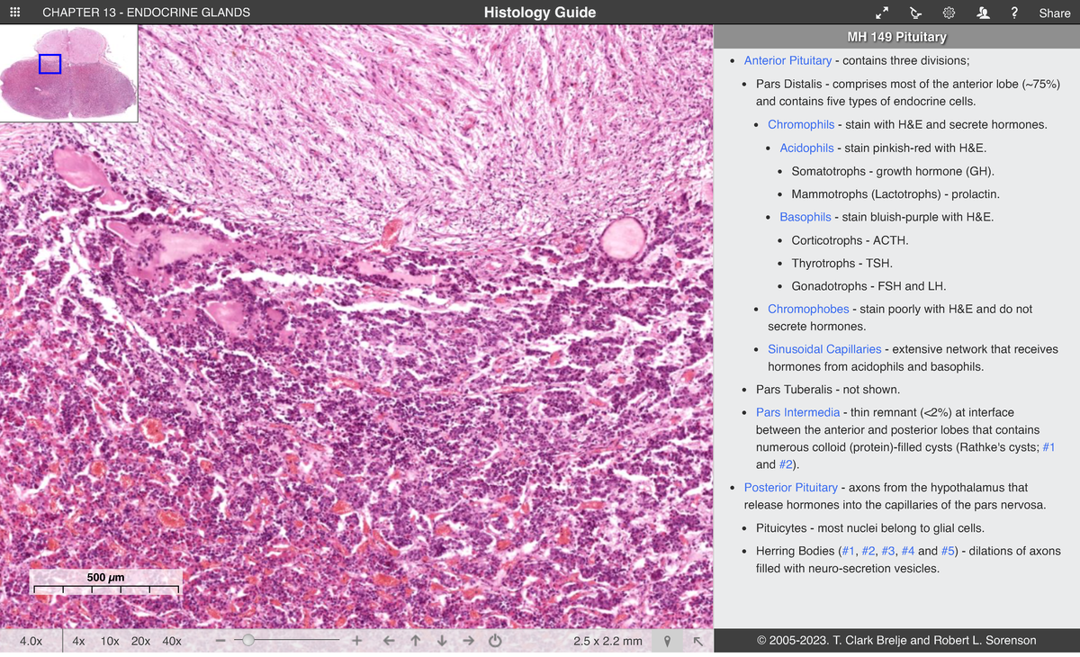 Pituitary Endocrine Glands - 500 μm Histology Guide CHAPTER 13 ...