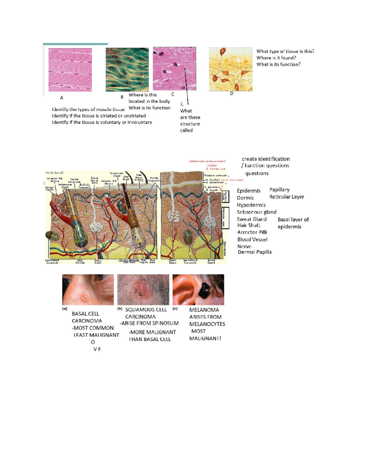 Chapter 45Tissue Skin Notes 925 - What type of tissue is this? Where is ...