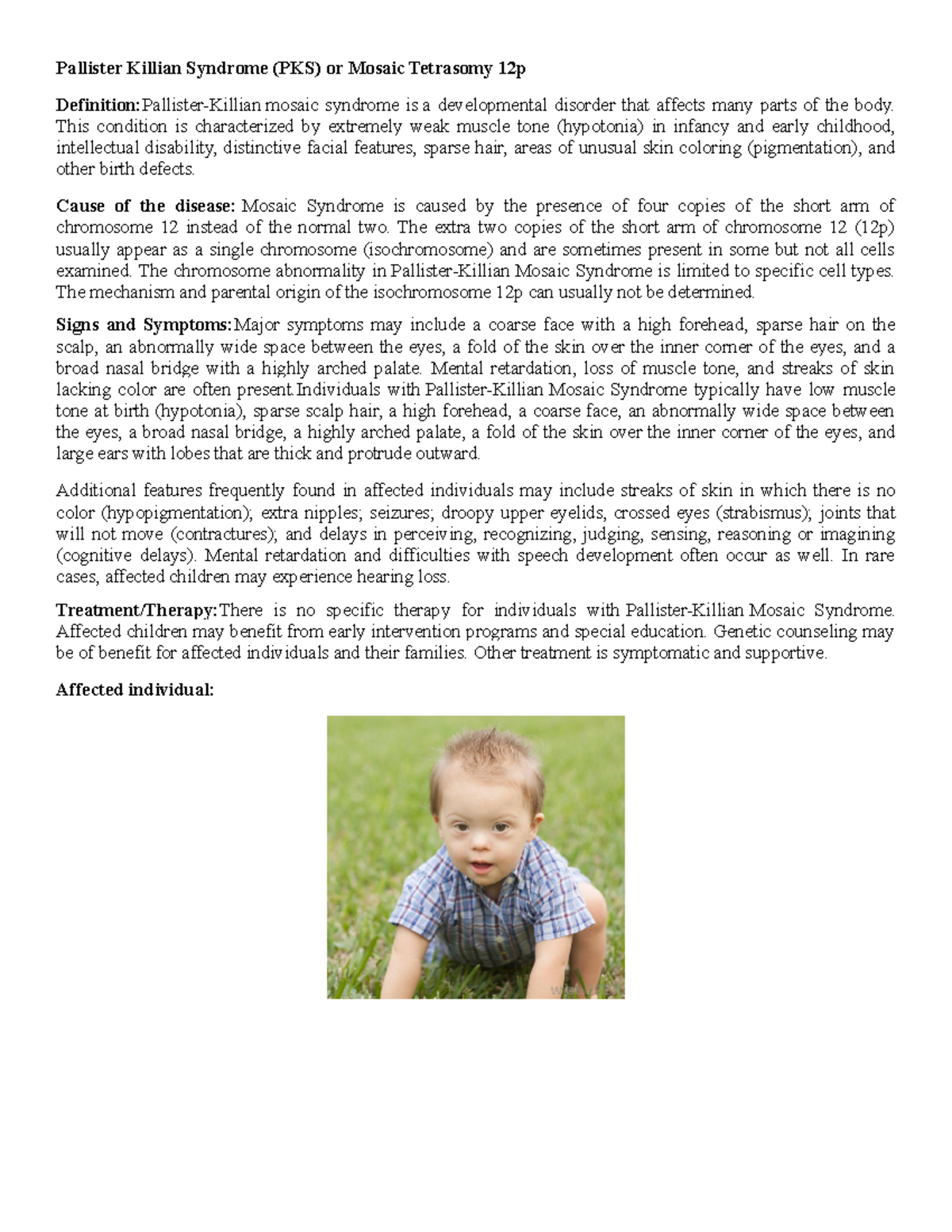 Genetics - Pallister Killian Syndrome (PKS) or Mosaic Tetrasomy 12p ...