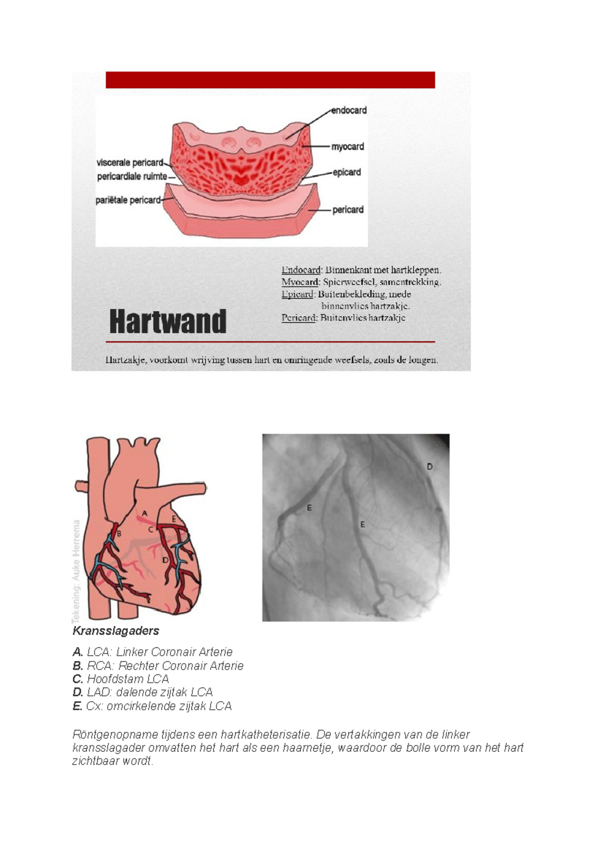 Kransslagaders - Samenvatting Medische theorie - Kransslagaders A. LCA ...