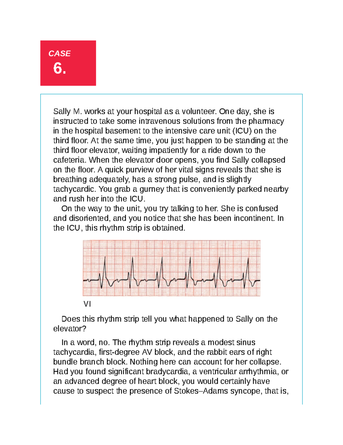 The only EKG-74 - The only EKG - CASE 6. Sally M. works at your ...